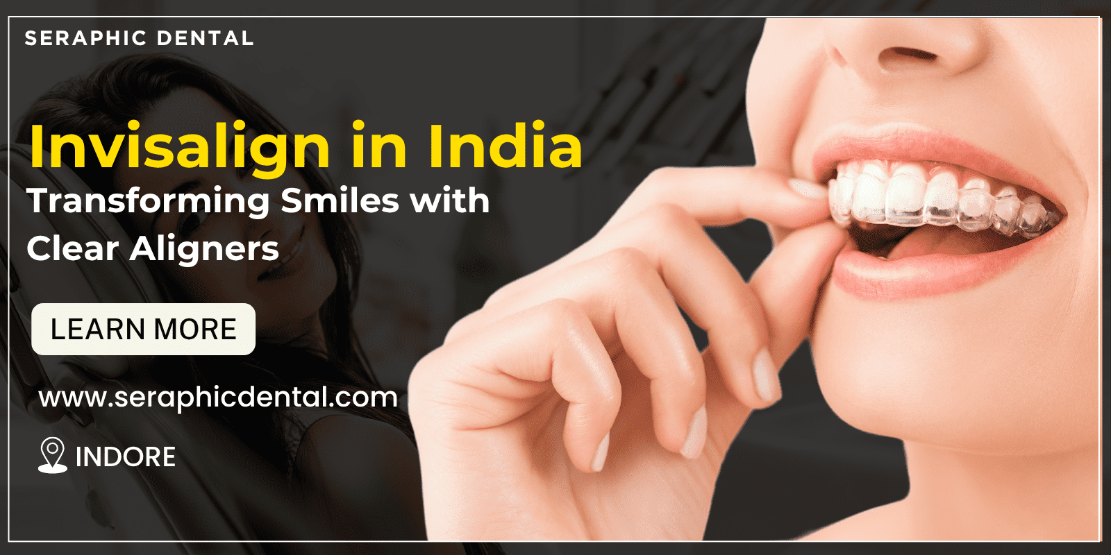 Invisalign in India: Transforming Smiles with Clear ...